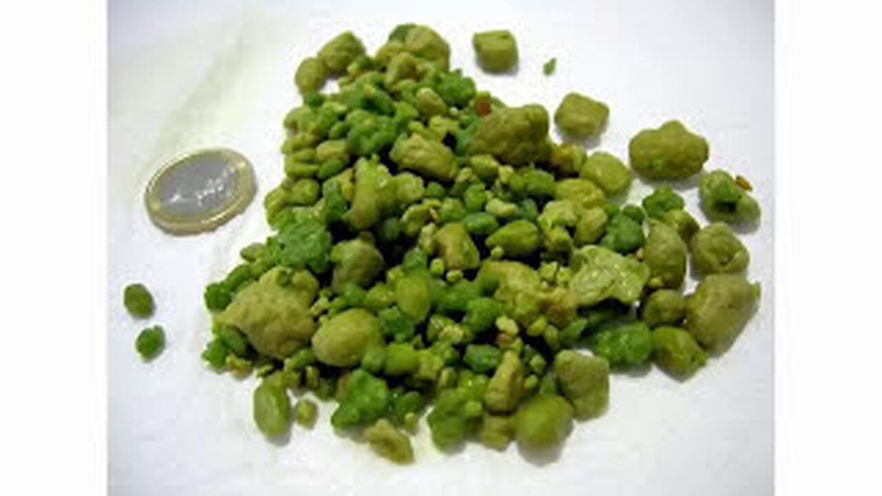 CALCULOS BILIARES PIEDRAS COLELITIASIS O - One News Page VIDEO