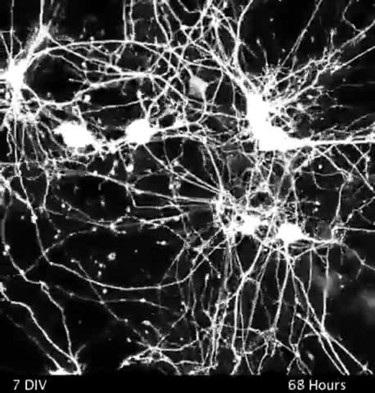 What it Looks Like When NEURONS make Connections - One News Page VIDEO
