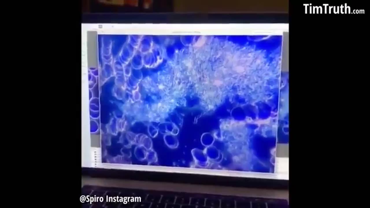 STRANGE OBJECTS, NANO WORMS, STRINGS, GRAPHENE - One News Page VIDEO STRANGE OBJECTS, NANO WORMS, STRINGS, GRAPHENE - One News Page VIDEO