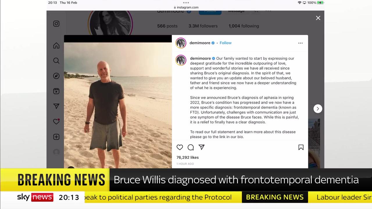Pray for Bruce Willis - One News Page VIDEO