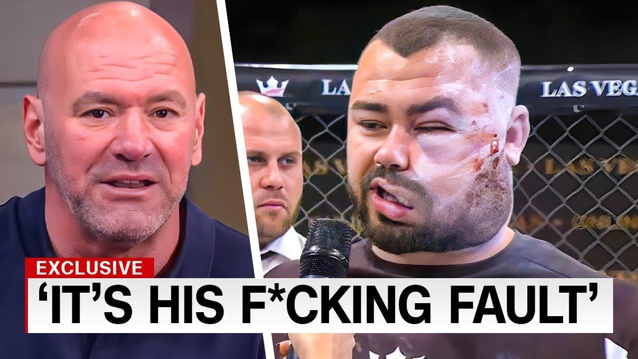 Slap Fighting Competitor Left DISFIGURED In - One News Page VIDEO Slap Fighting Competitor Left DISFIGURED In - One News Page VIDEO