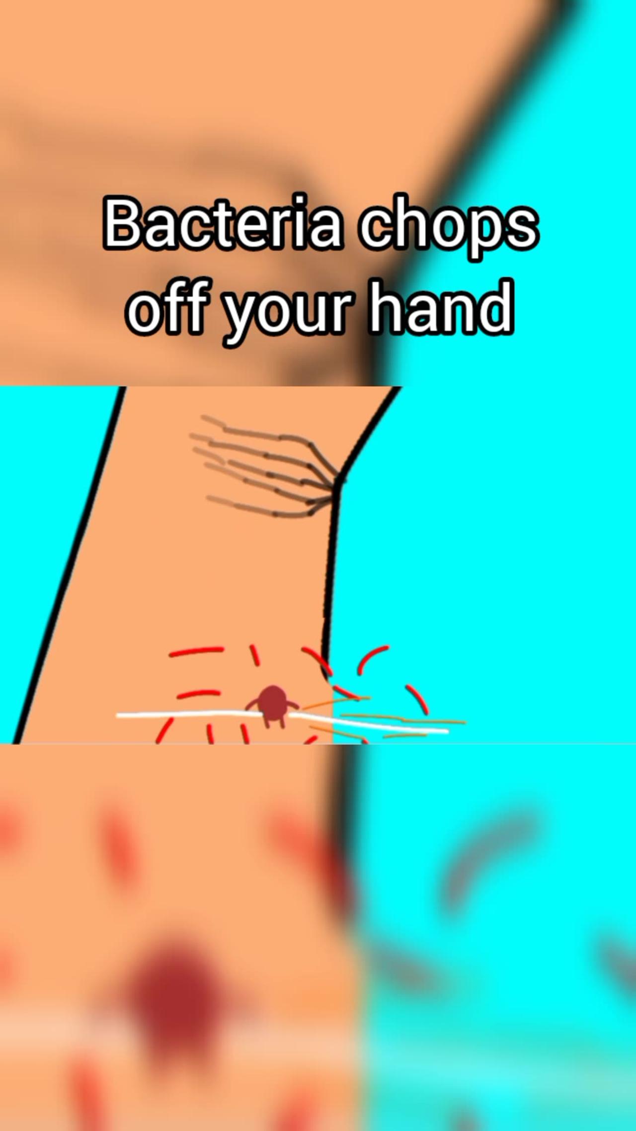 Bacteria Chops Off Your Hand - One News Page VIDEO