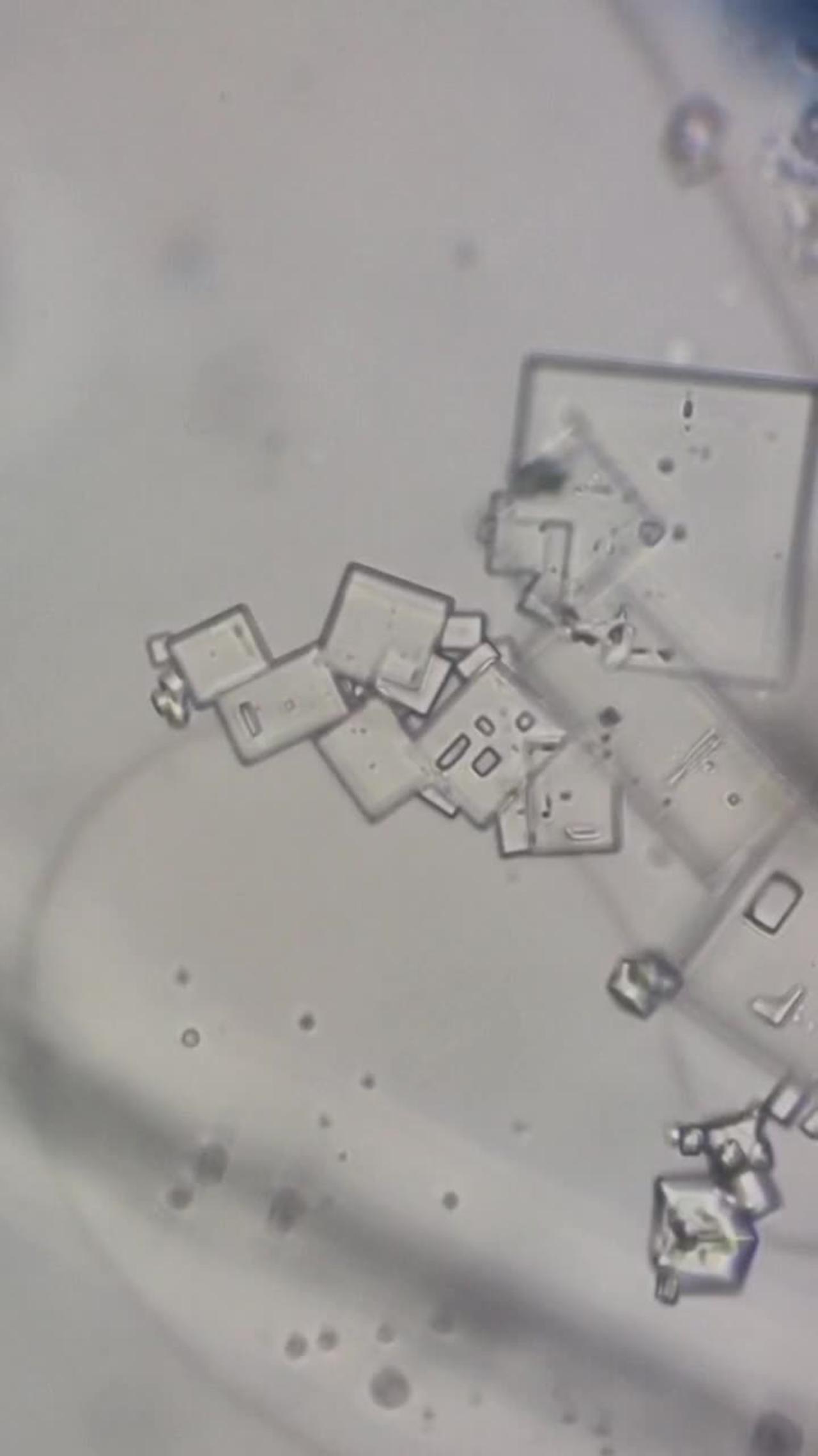 Seeing inside Vaccines using electron microscope - One News Page VIDEO