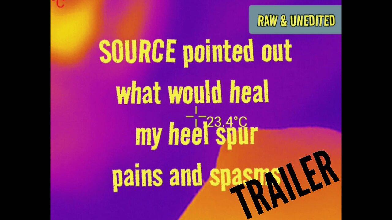 Painful heel spur spasms preventing sleep. - One News Page VIDEO