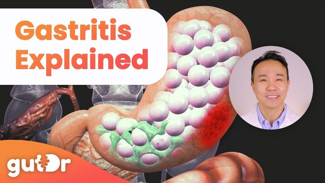 What is Gastritis? | The GutDr Explains (3D Gut - One News Page VIDEO