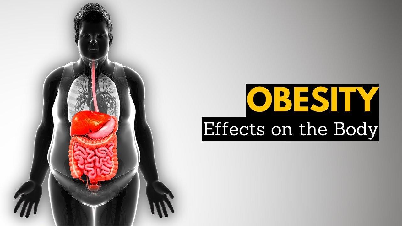 Obesity, Causes, SIgns and Symptoms, Diagnosis - One News Page VIDEO
