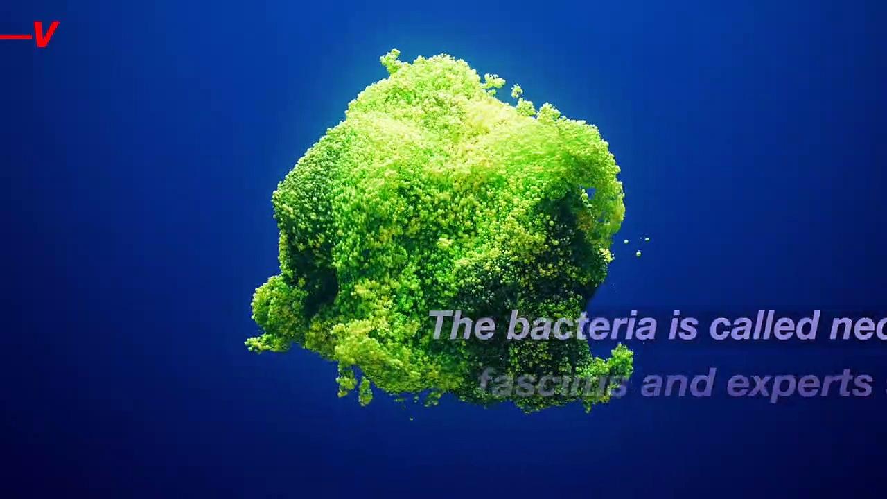 California Man Dies of Flesh Eating Bacteria - One News Page VIDEO