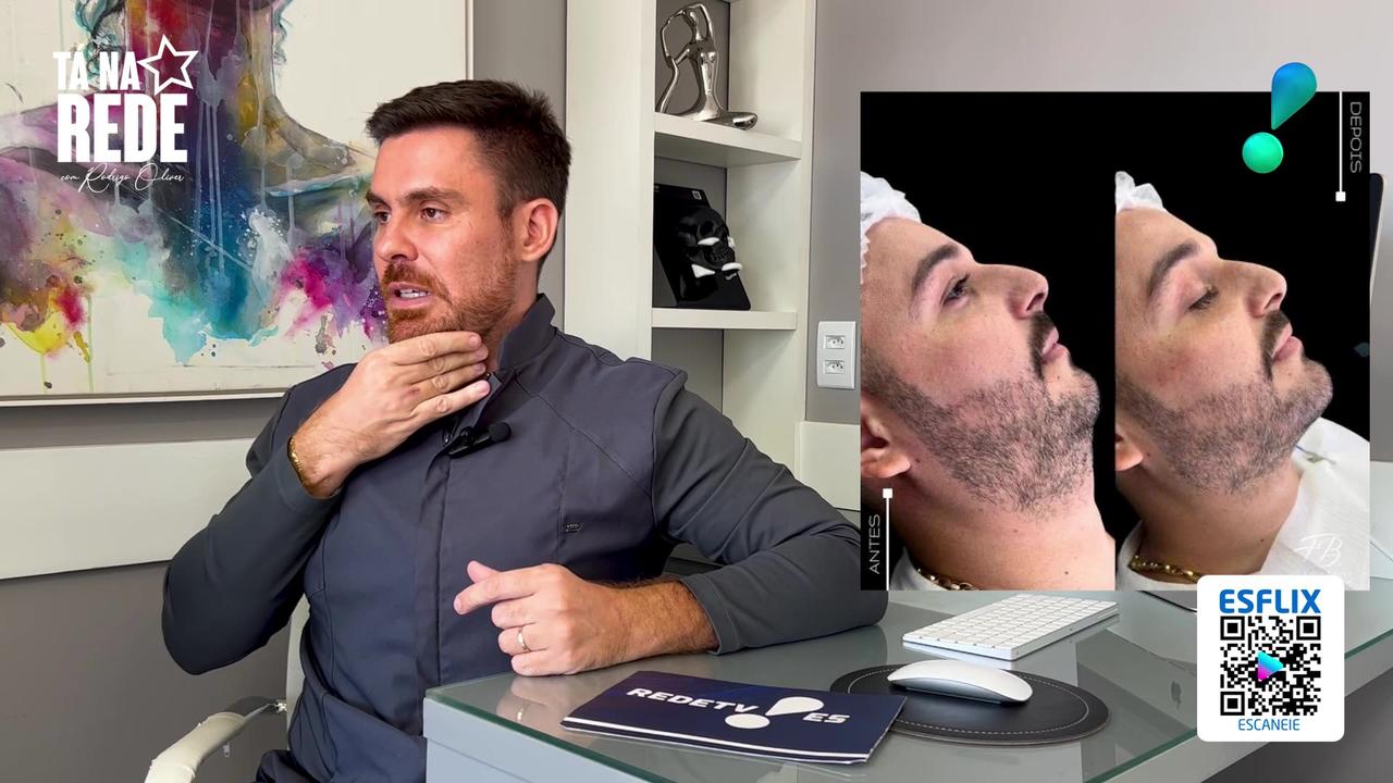 Fabio Barros fez uma matéria sobre a Papada na - One News Page VIDEO