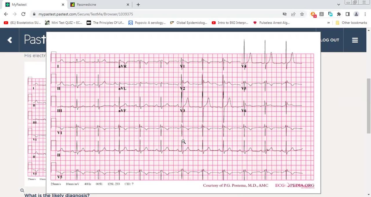 Pastest MRCP II Cardiology 5 - One News Page VIDEO