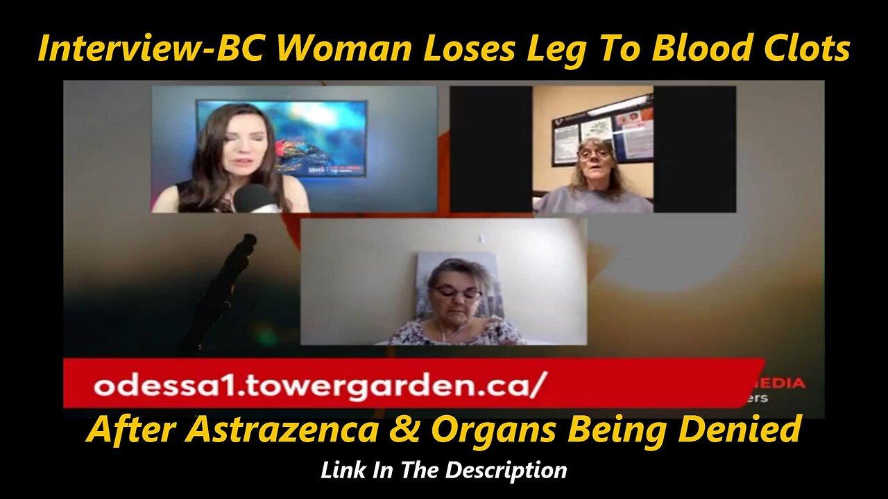 Interview-BC Woman Loses Leg To Blood Clots - One News Page VIDEO