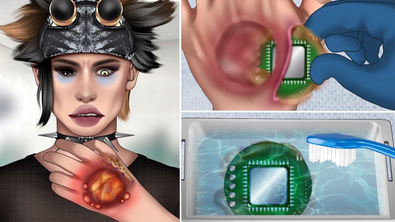 ASMR Remove biohacking implants on back of the - One News Page VIDEO