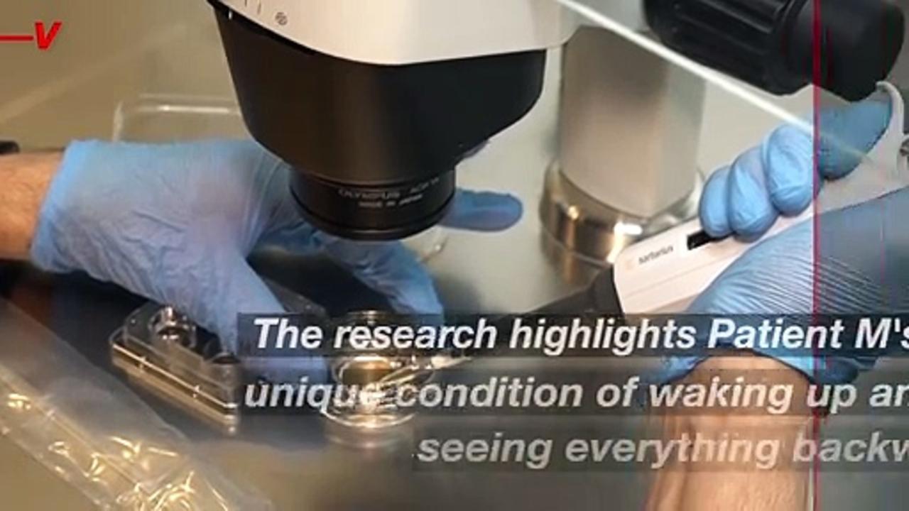 Learn About The Man Who Was Shot In The Head & - One News Page VIDEO