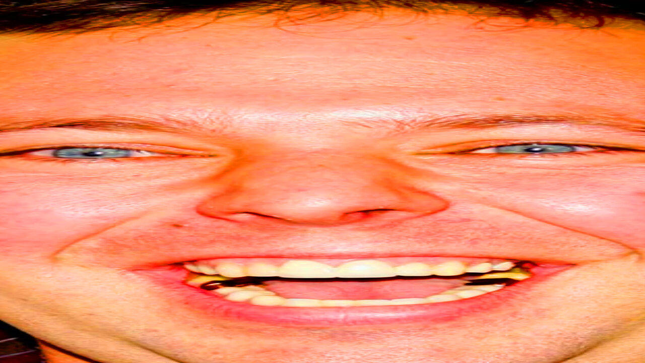 The video stops when Bert Kreischer makes me - One News Page VIDEO