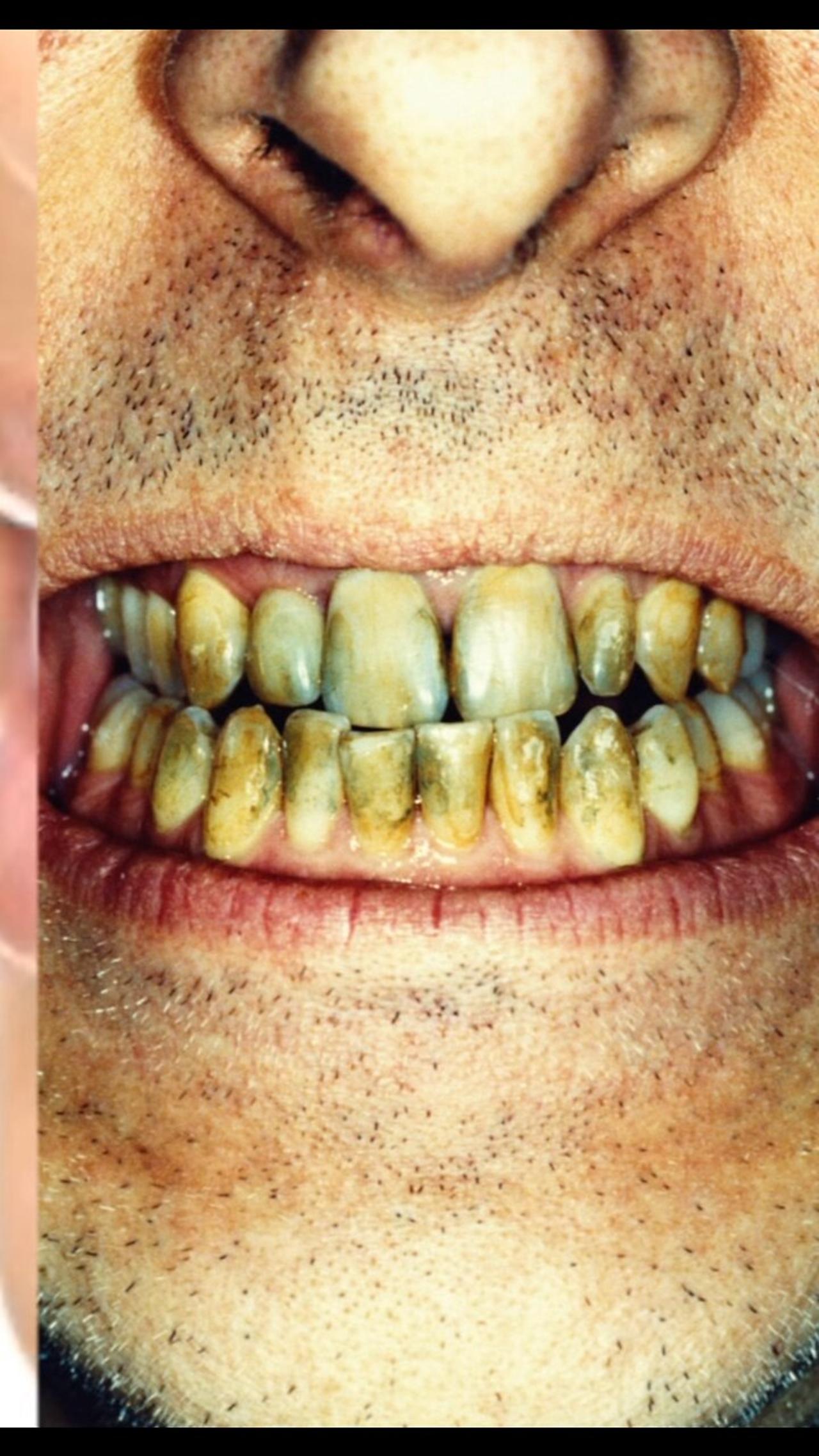 If only there was an AI that could whiten your - One News Page VIDEO