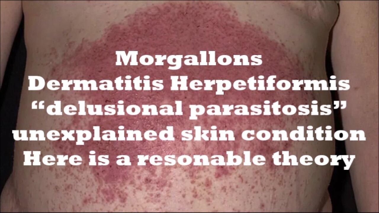 Morgellons Black Goo Harald Kautz Vella English - One News Page VIDEO