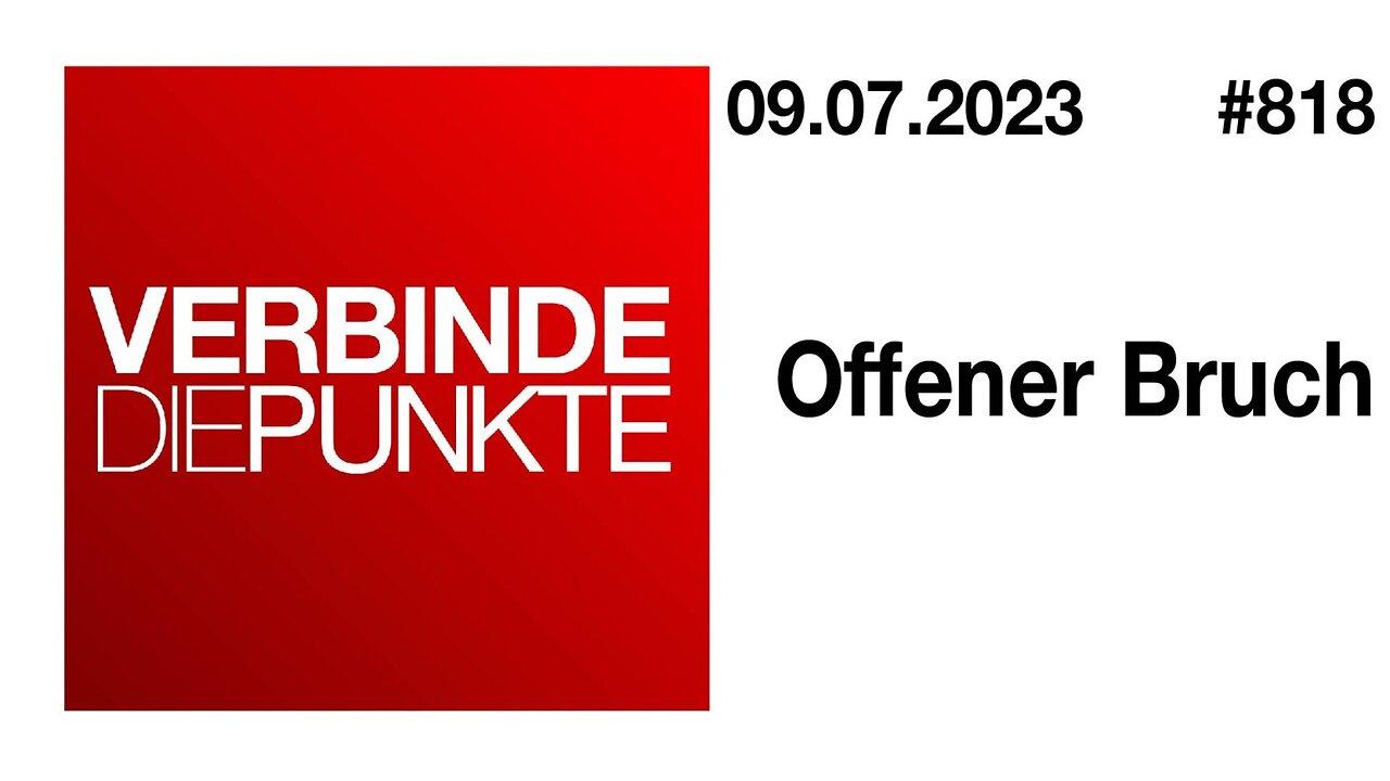 Verbinde die Punkte 818 - Offener Bruch vom - One News Page VIDEO