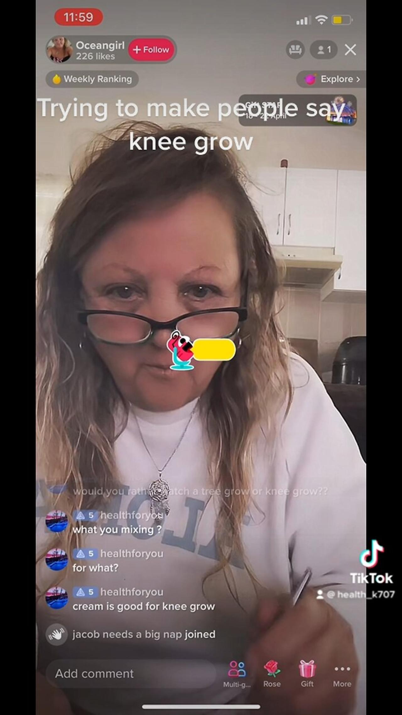 Tiktok knee grow part2 - One News Page VIDEO