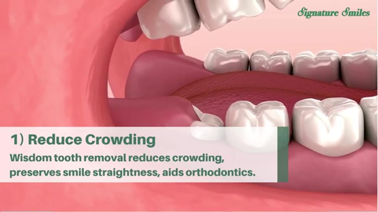Reasons to Have Wisdom Teeth Removed - One News Page VIDEO