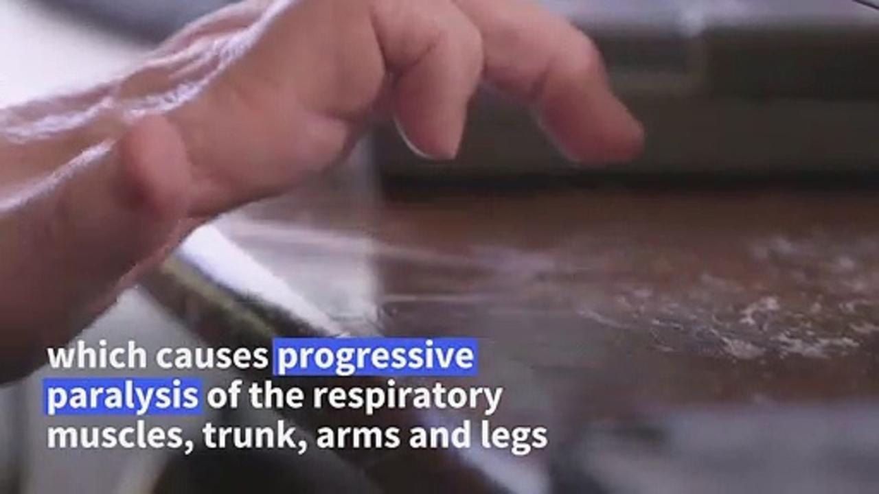 ALS patient pioneering brain-computer connection - One News Page VIDEO