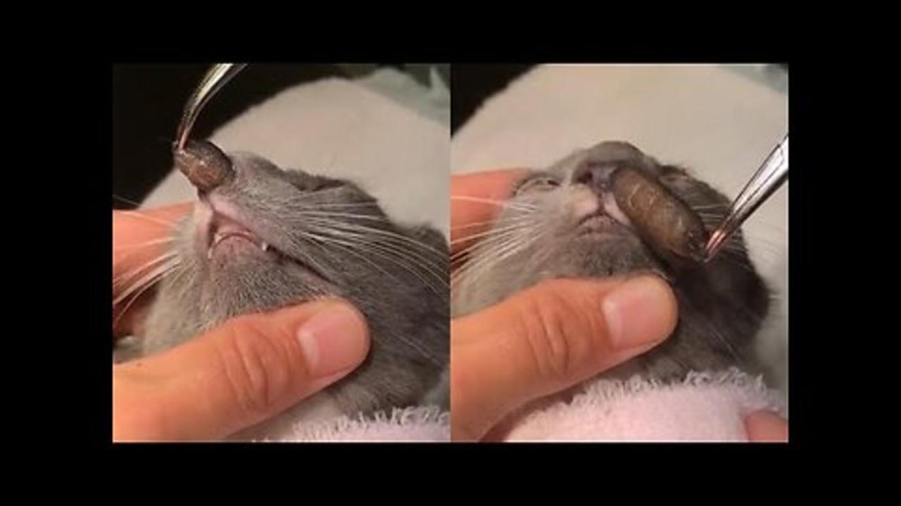 Removing A Huge Botfly Maggot Inside A - One News Page VIDEO