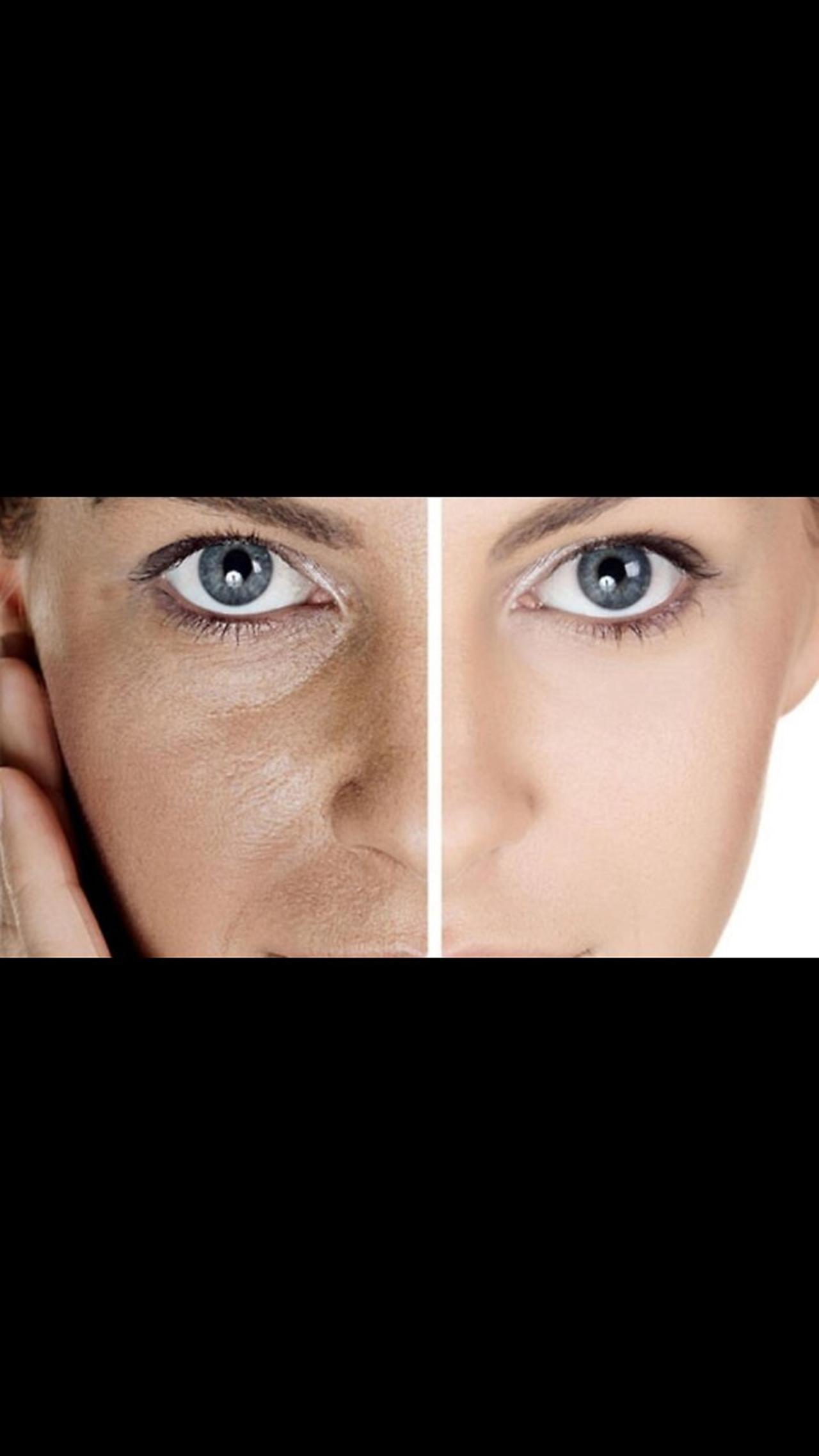 Top 3 Home Remedies for Clear Open Pores 🌿 - One News Page VIDEO