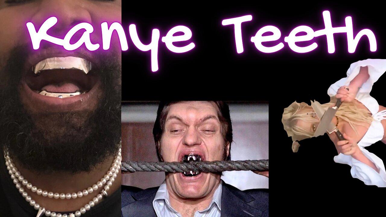 Kanye West Teeth EMERGENCY STREAM!!! - One News Page VIDEO