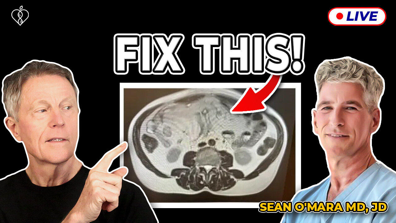 5 Things You MUST Do To Reverse Visceral FAT - One News Page VIDEO 5 Things You MUST Do To Reverse Visceral FAT - One News Page VIDEO