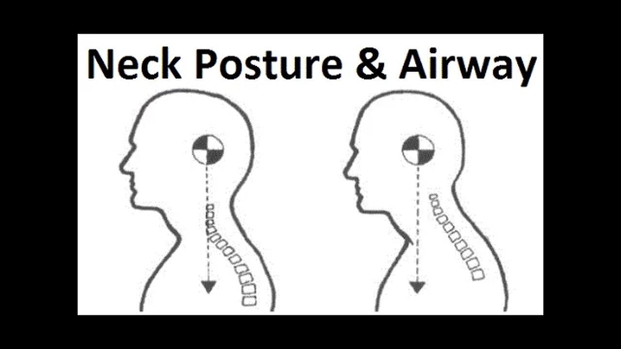 Chronic Cerebrospinal Venous insufficiency - One News Page VIDEO
