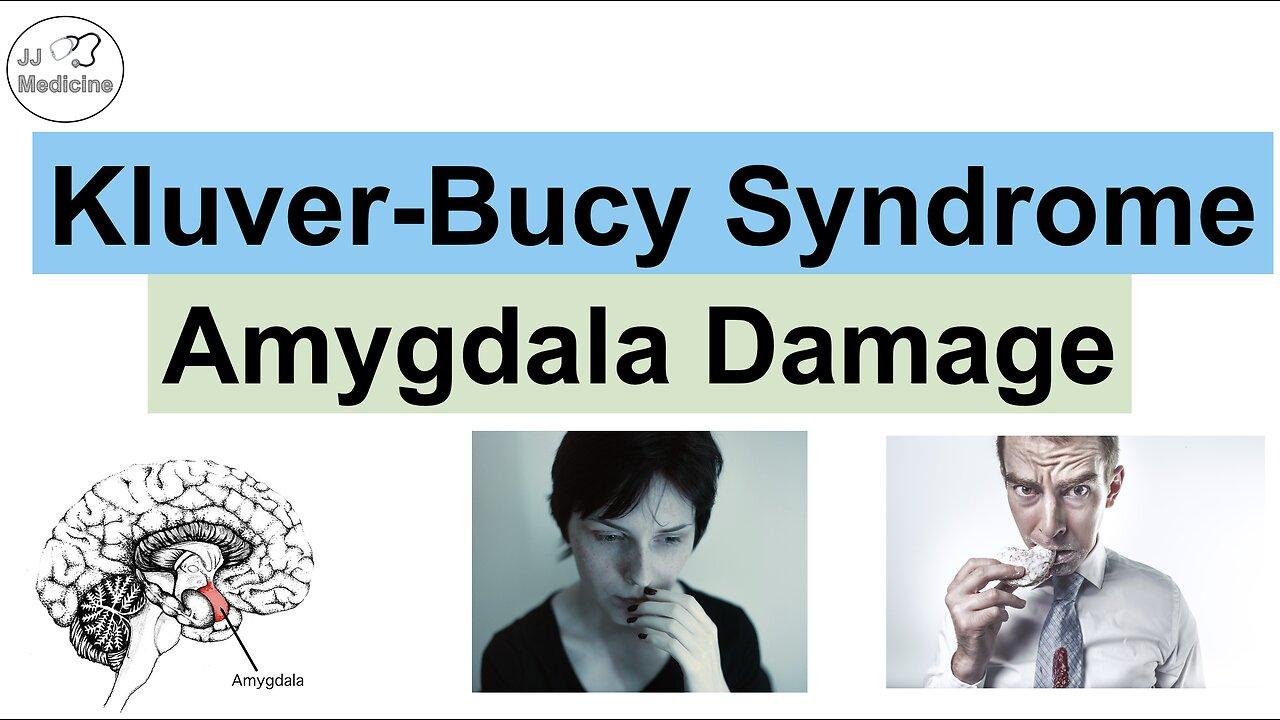 Kluver-Bucy Syndrome | Causes, Pathophysiology, - One News Page VIDEO