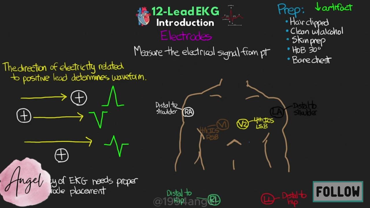 Introduction to Concepts of 12-Lead EKG - One News Page VIDEO